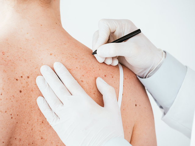 The Skin Cancer Professionals - Noosa Skin Cancer Surgery